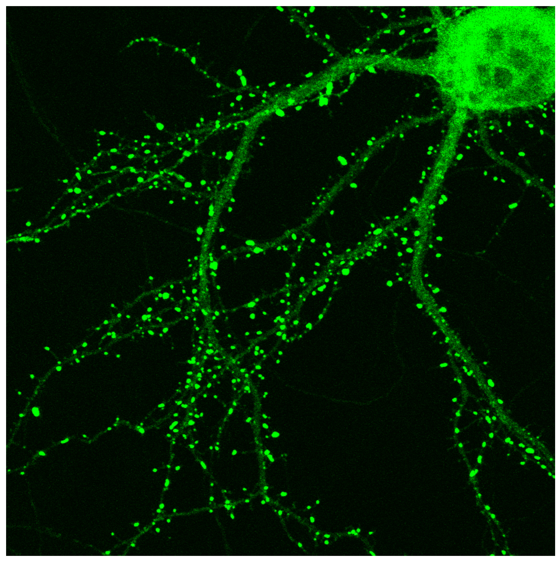 Calcium Phosphate Transfection of Primary Hippocampal Neurons | Text Page