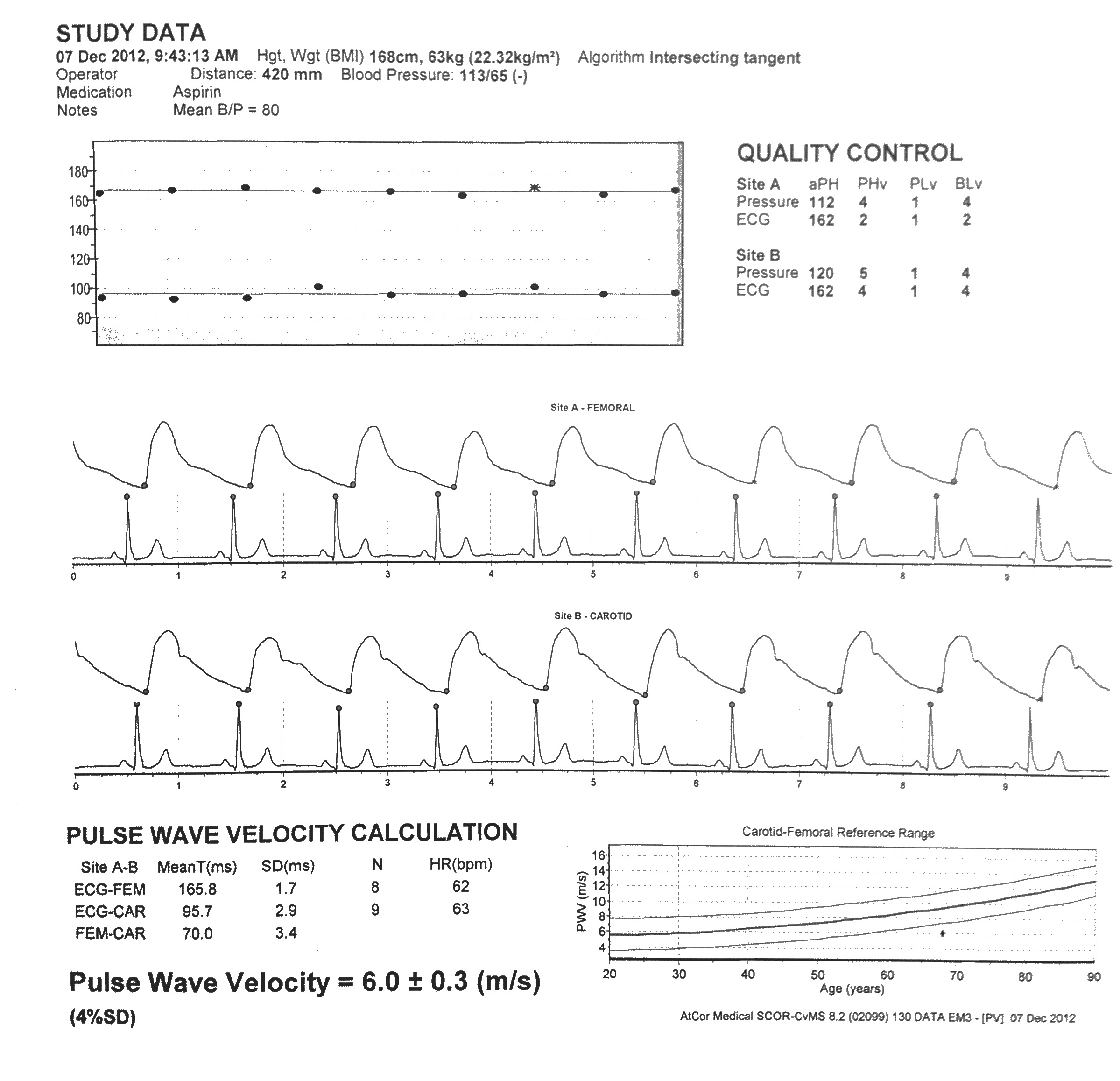 Pulse Wave Velocity Testing in the Baltimore Longitudinal Study of ...