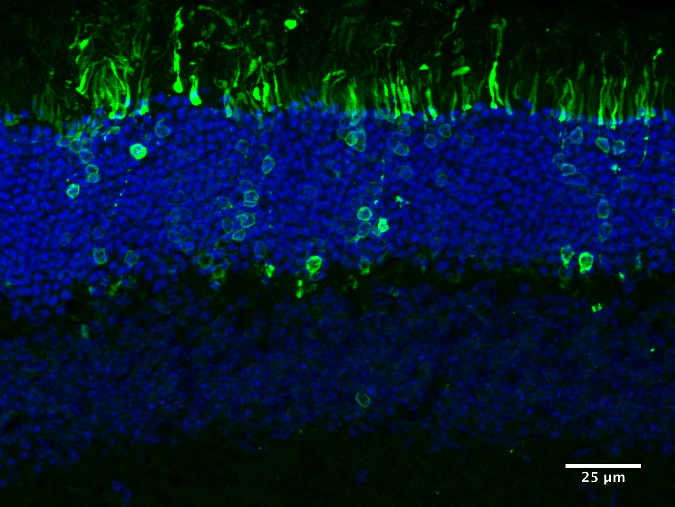 Subretinal Transplantation of MACS Purified Photoreceptor Precursor ...