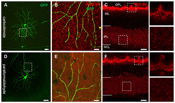 Optimized Protocol for Retinal Wholemount Preparation for Imaging and ...
