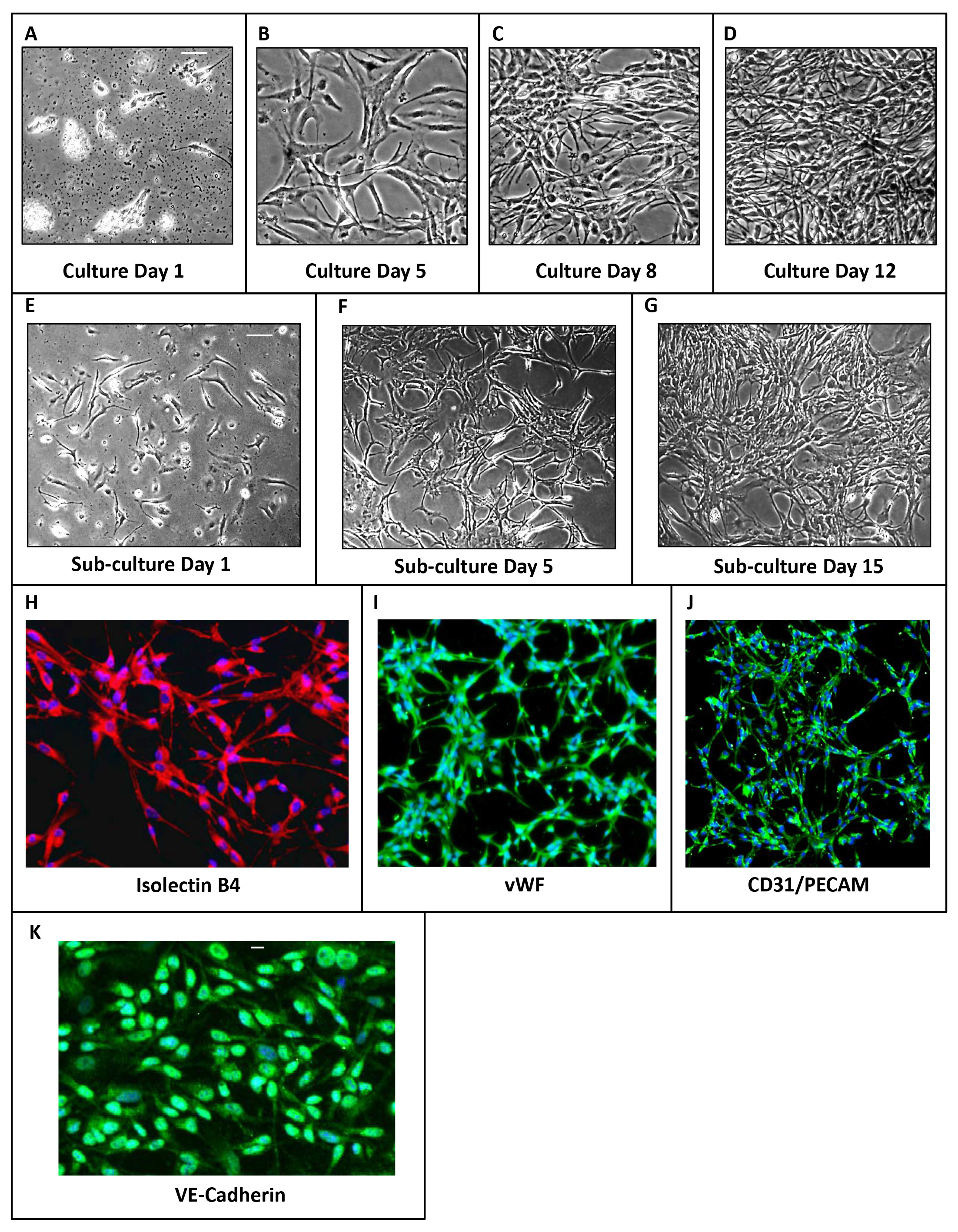 Isolation and Culture of Endothelial Cells from the Embryonic Forebrain ...