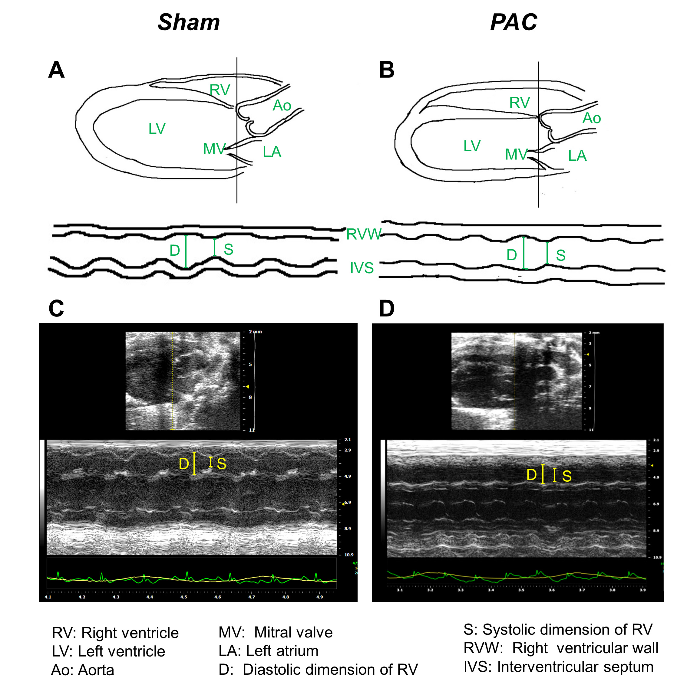 Assessment of Right Ventricular Structure and Function in Mouse Model ...