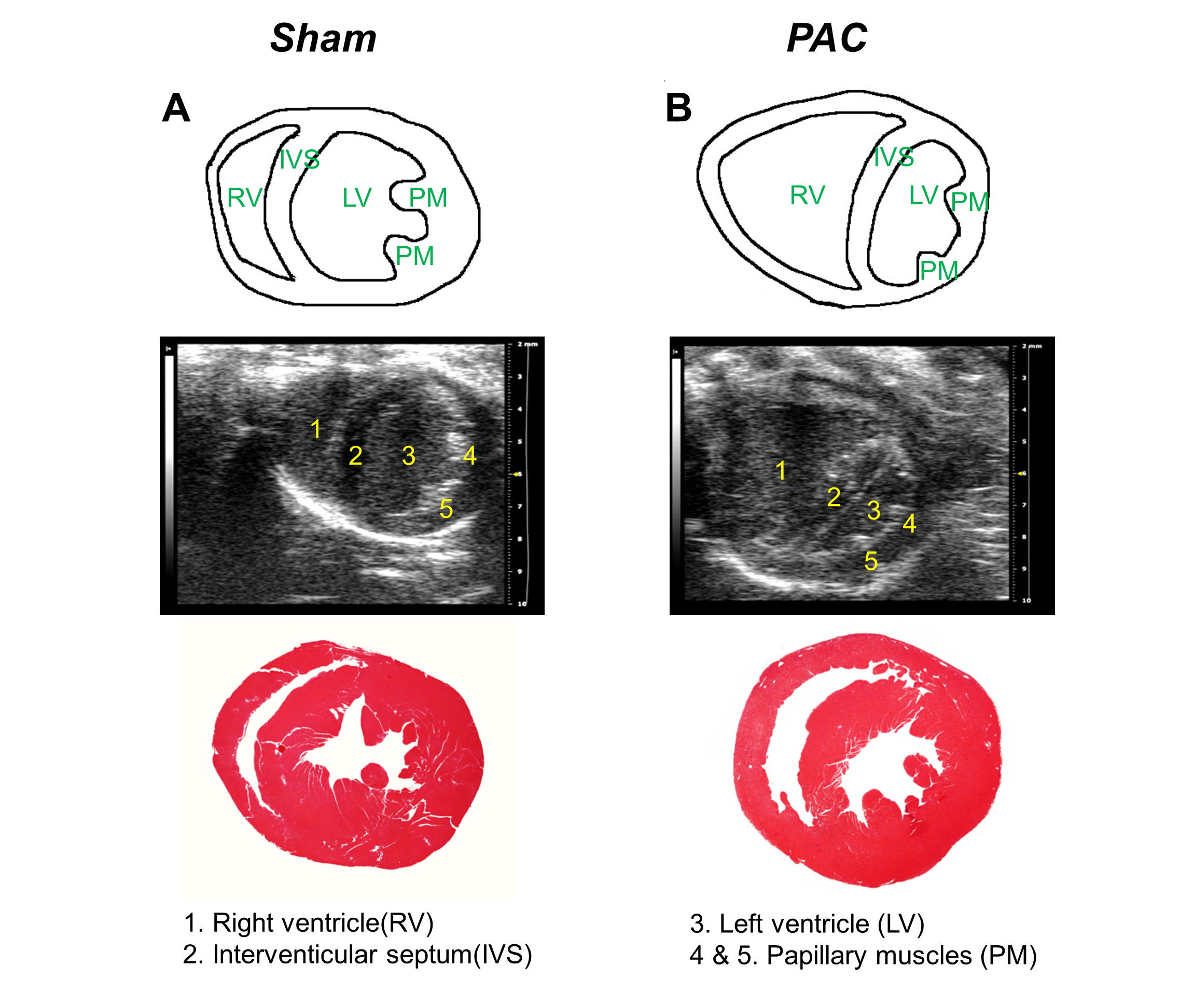 Assessment of Right Ventricular Structure and Function in Mouse Model ...