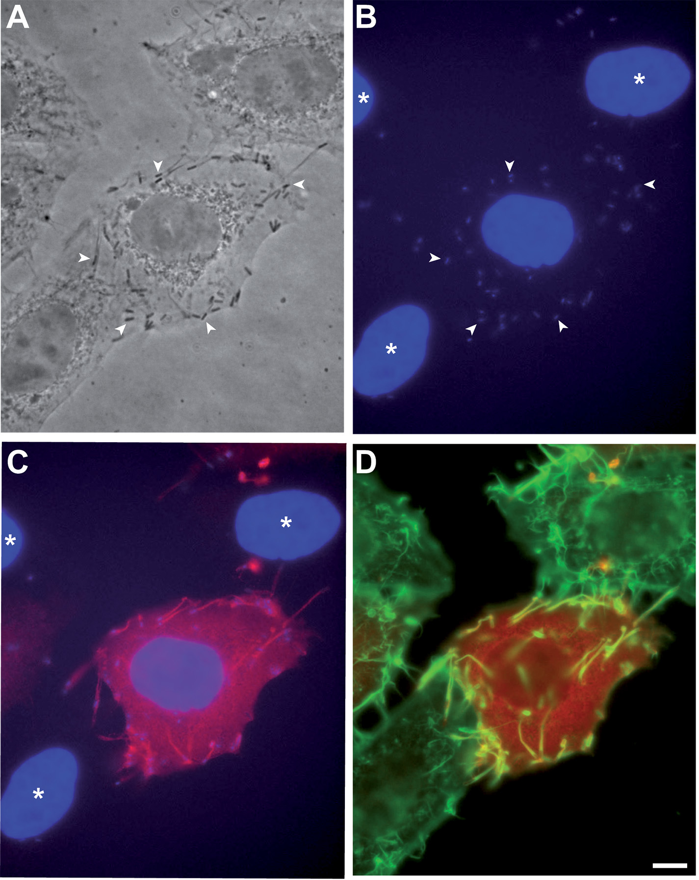 Imaging InlC Secretion to Investigate Cellular Infection by the ...