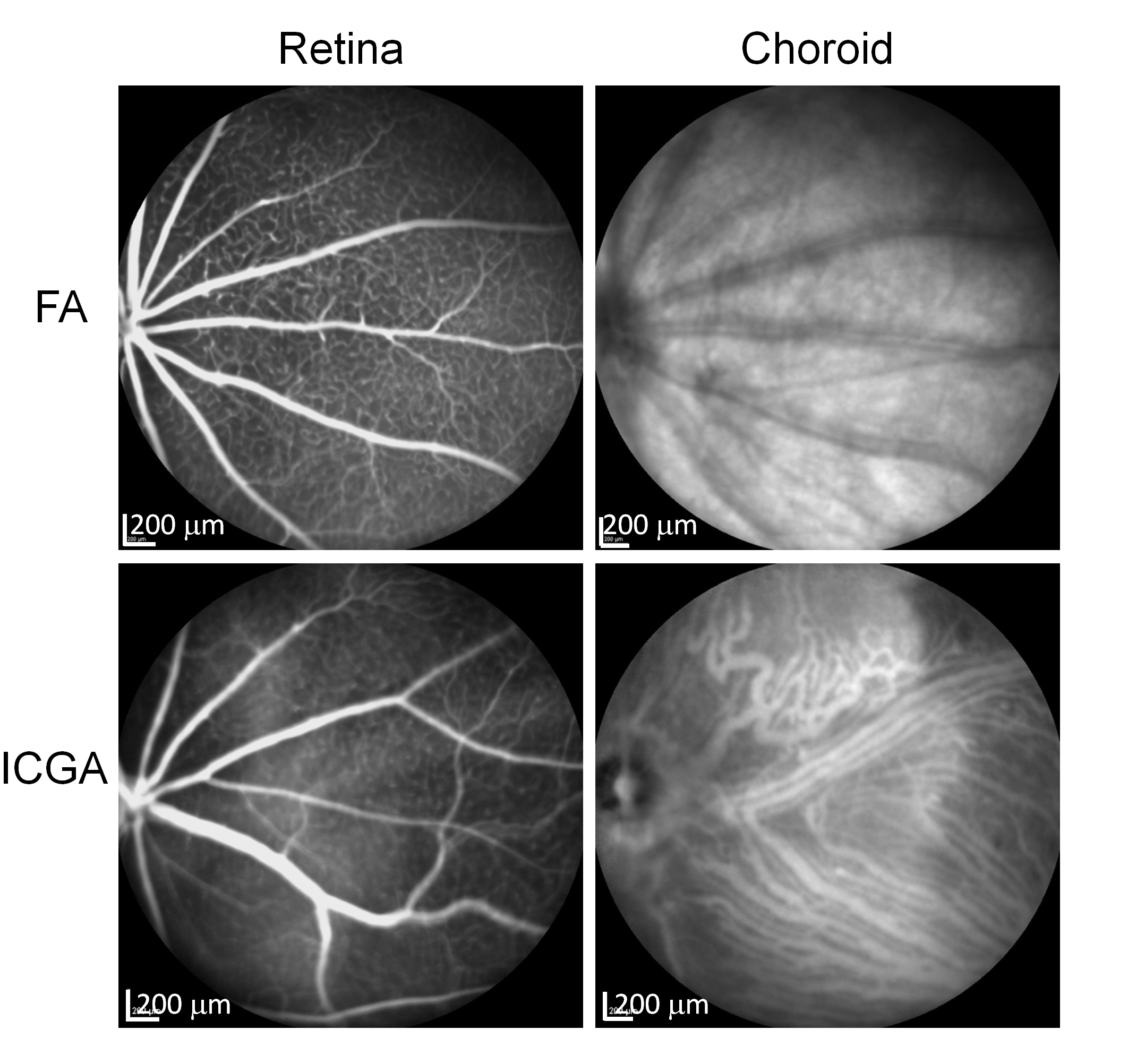 Detecting Abnormalities in Choroidal Vasculature in a Mouse Model of ...