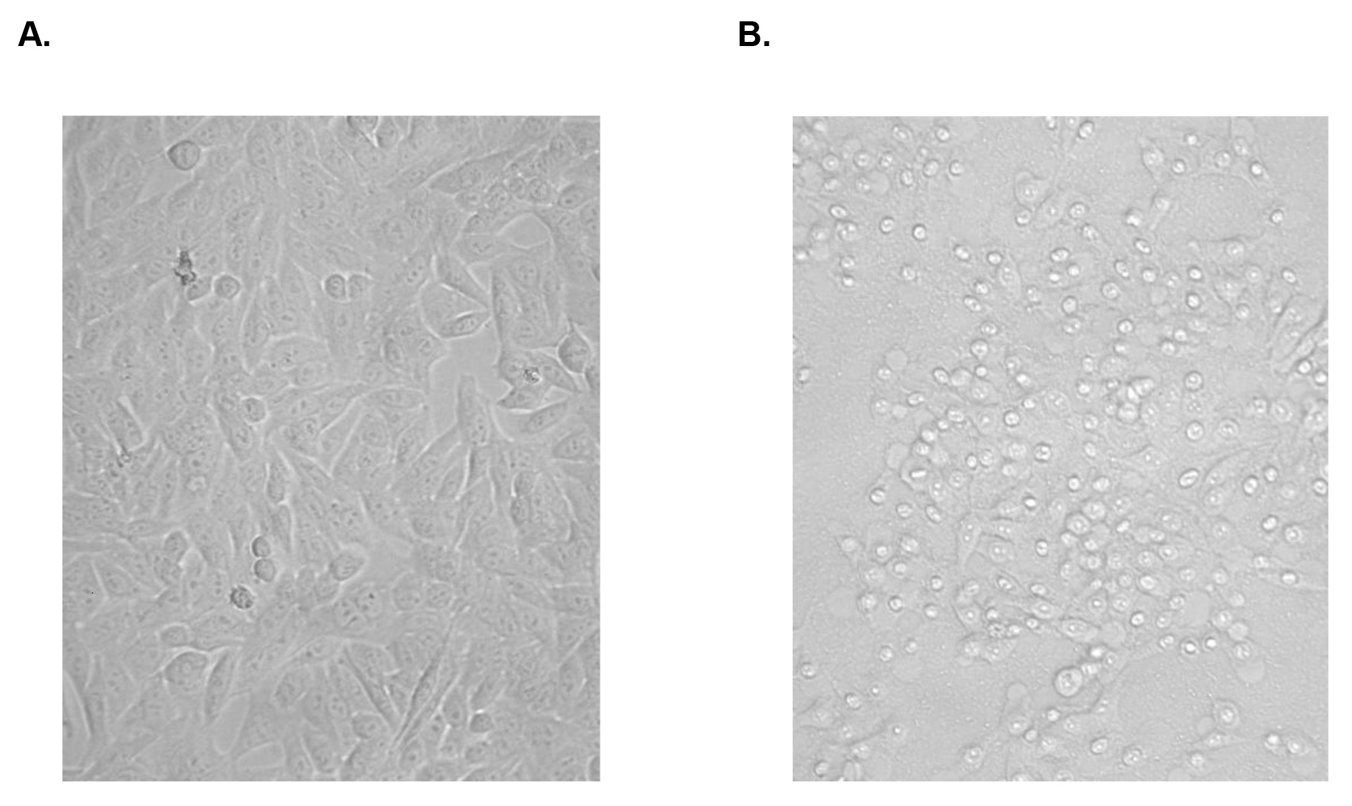 Investigating the Effects of Probiotics on Pneumococcal Colonization ...