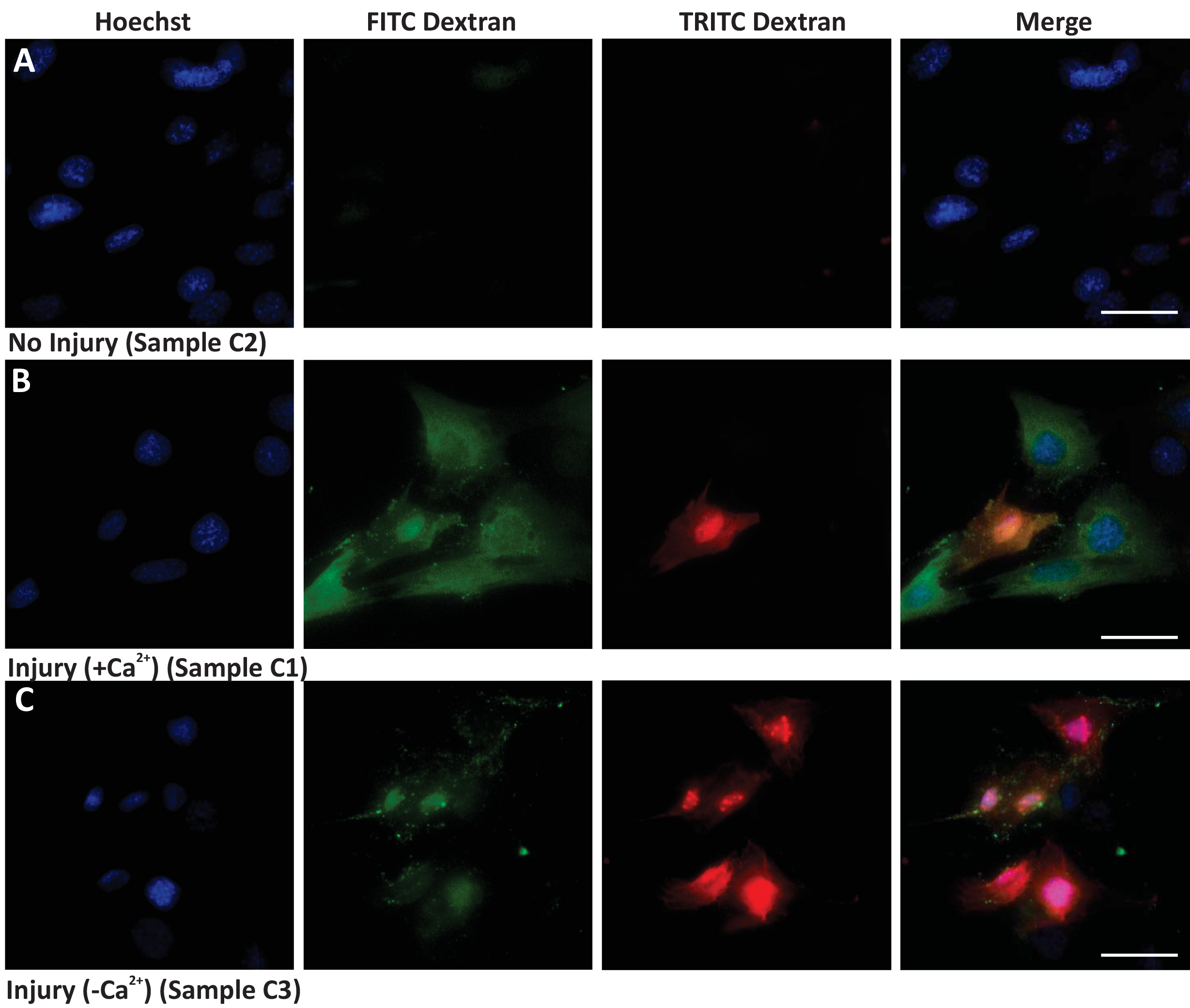 Imaging Cell Membrane Injury and Subcellular Processes Involved in ...