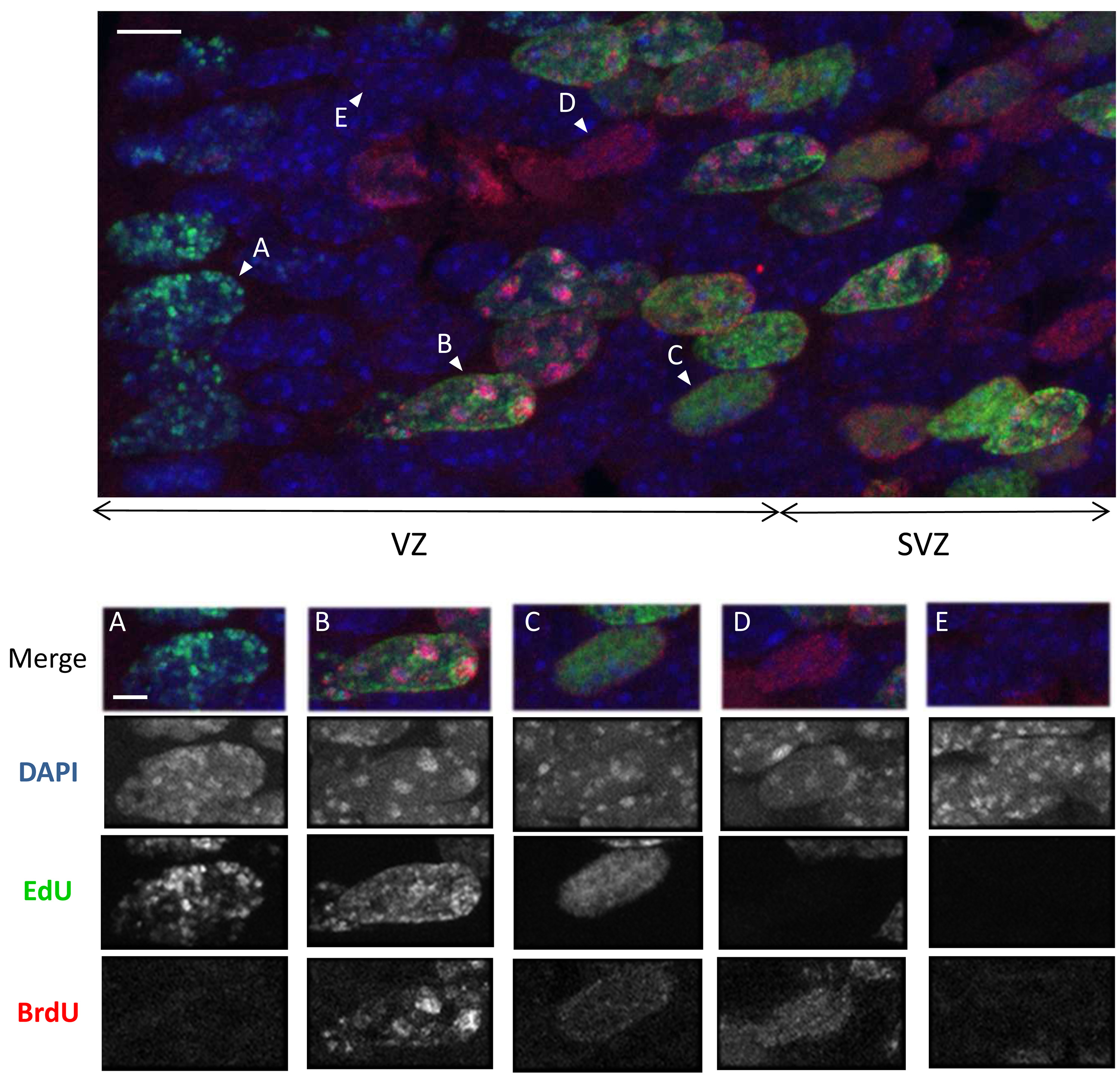 Assessing Cell Cycle Progression of Neural Stem and Progenitor Cells in ...
