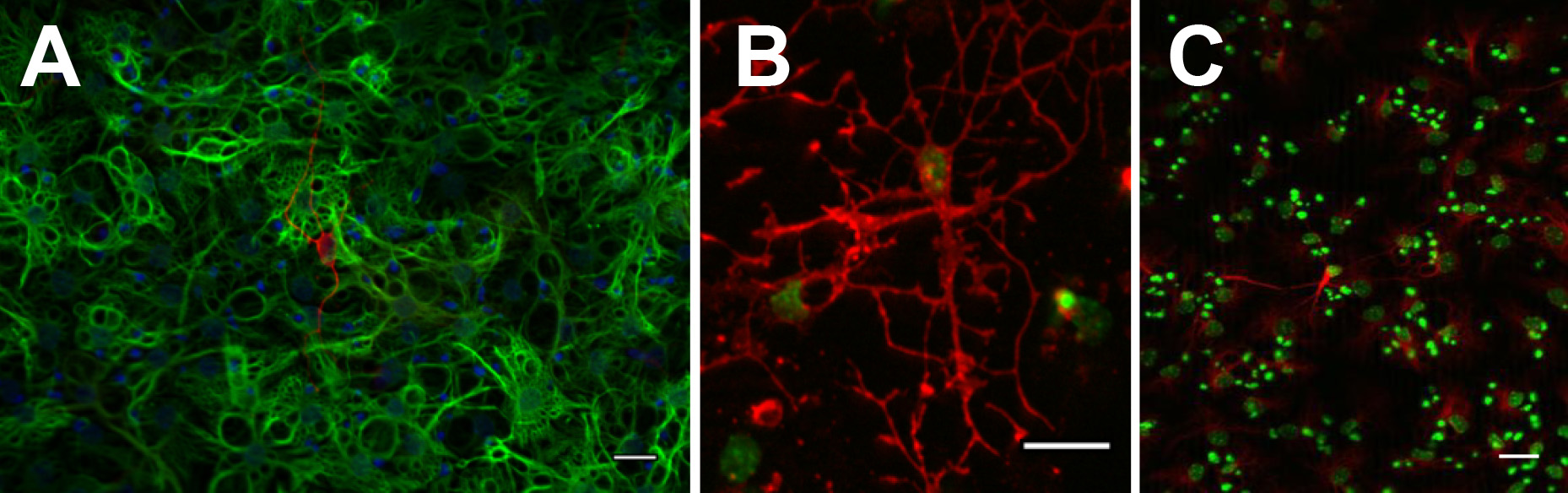 One Mouse, Two Cultures: Isolation and Culture of Adult Neural Stem ...