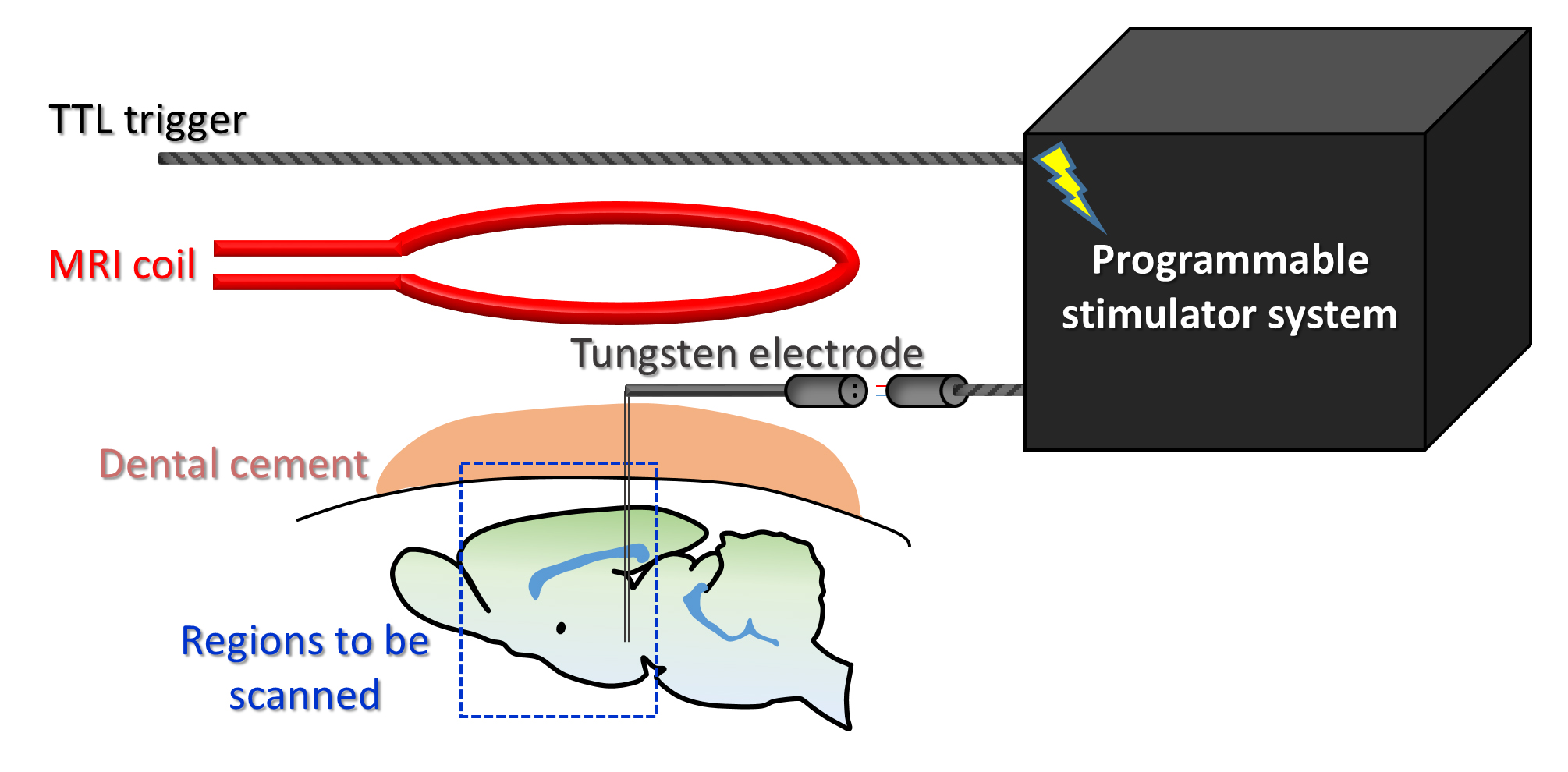 Deep Brain Stimulation with Simultaneous fMRI in Rodents (Scientific ...