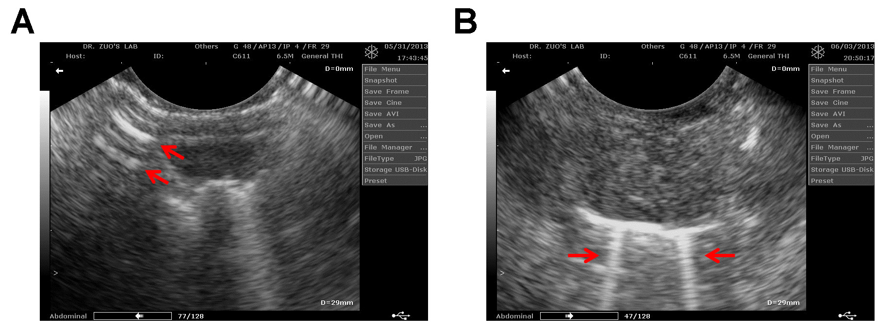 Diagnostic Ultrasound Imaging of Mouse Diaphragm Function | Protocol