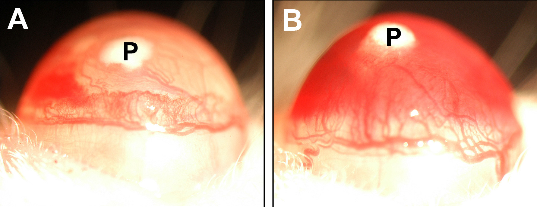The Corneal Micropocket Assay: A Model of Angiogenesis in the Mouse Eye ...