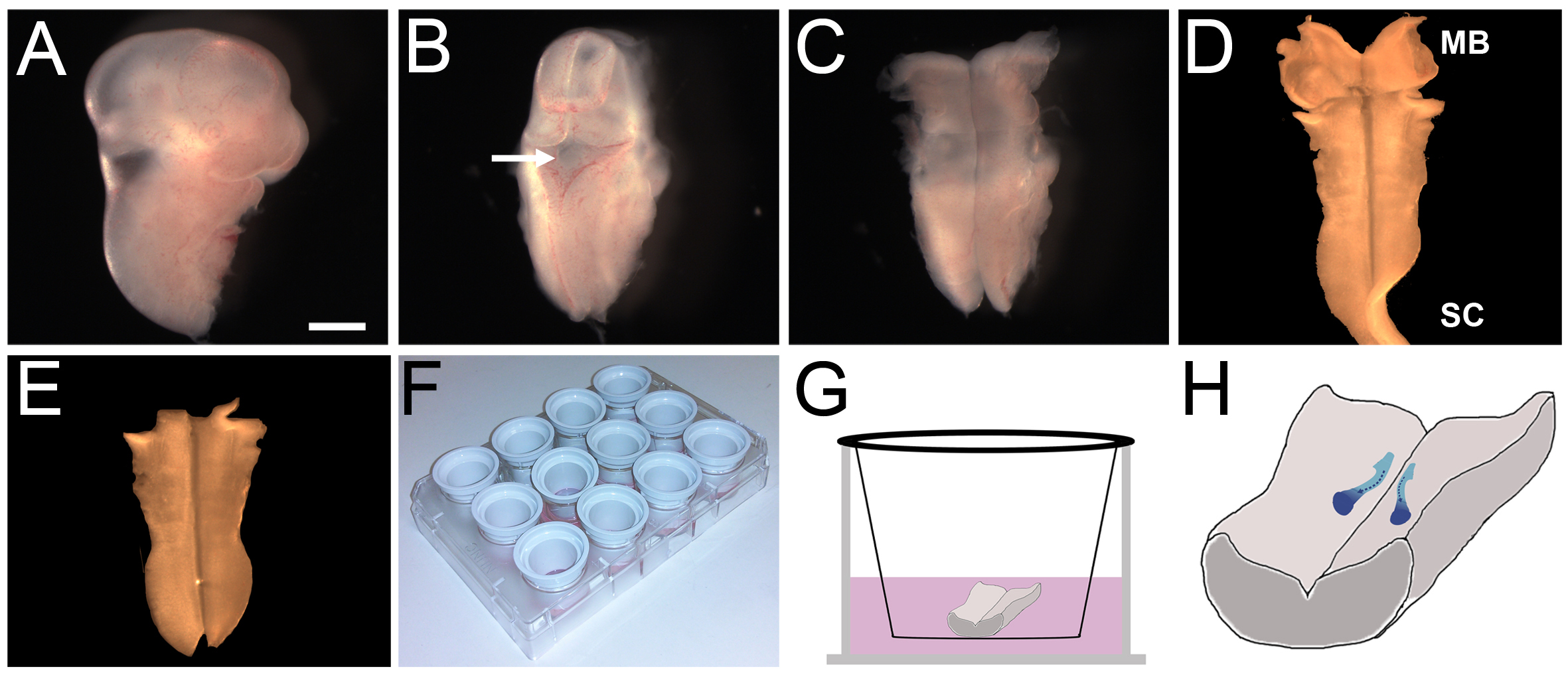 Mouse Hindbrain Ex Vivo Culture to Study Facial Branchiomotor Neuron ...