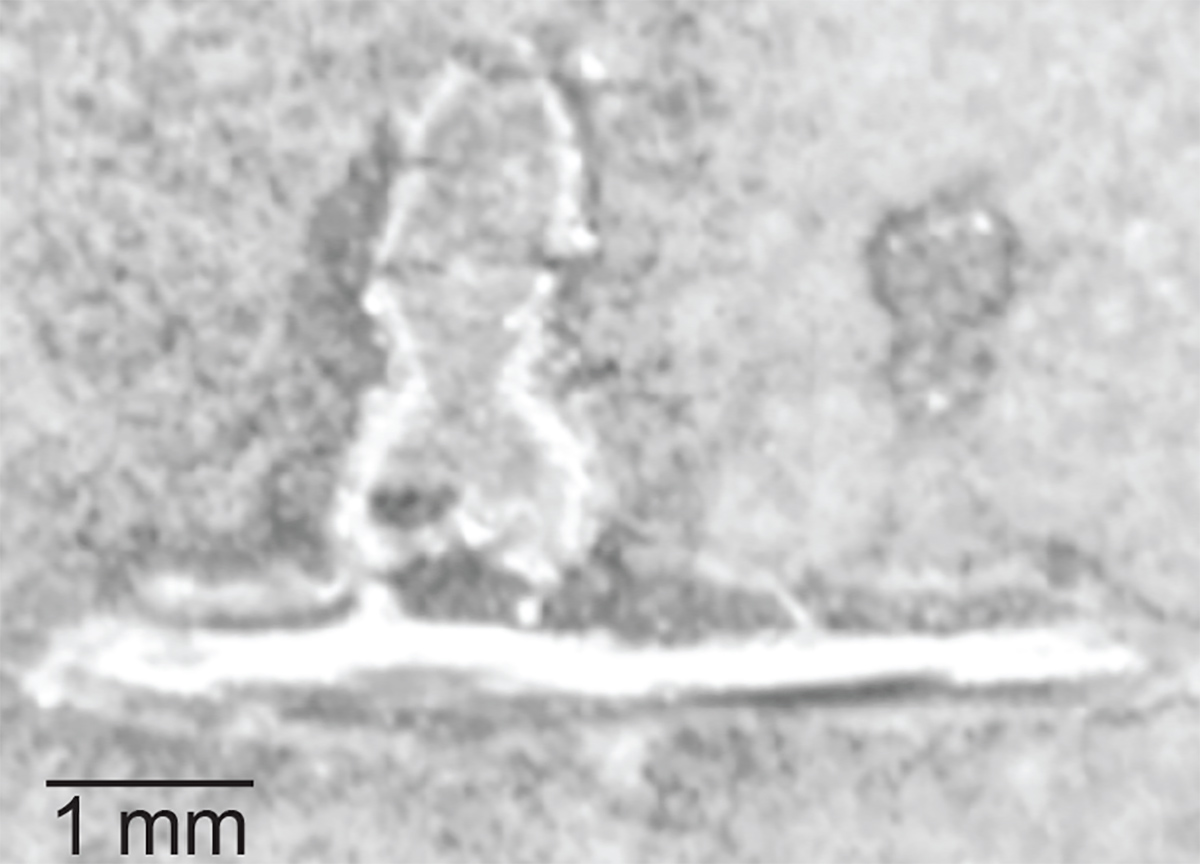 MALDI-Mass Spectrometric Imaging for the Investigation of Metabolites ...