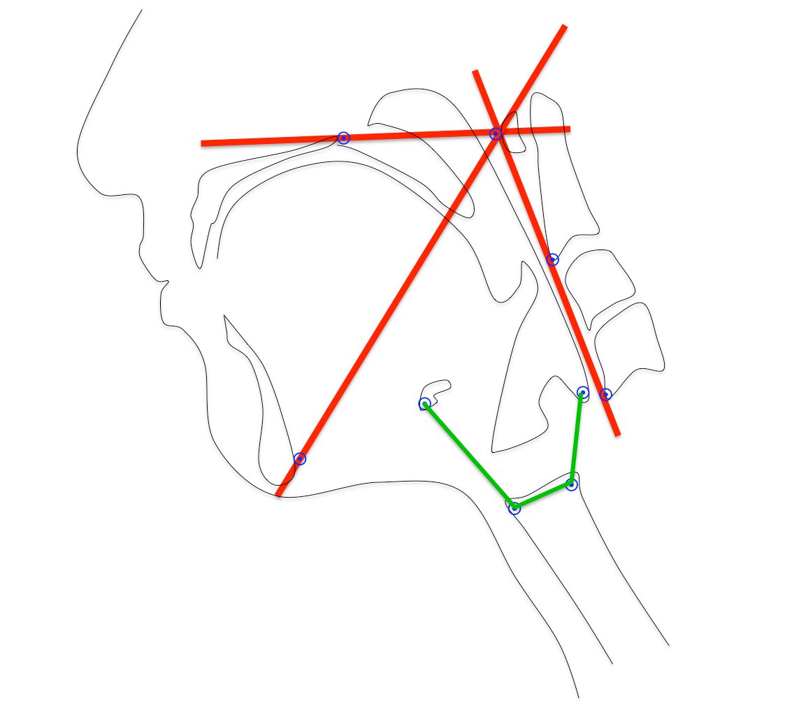 Coordinate Mapping of Hyolaryngeal Mechanics in Swallowing | Protocol