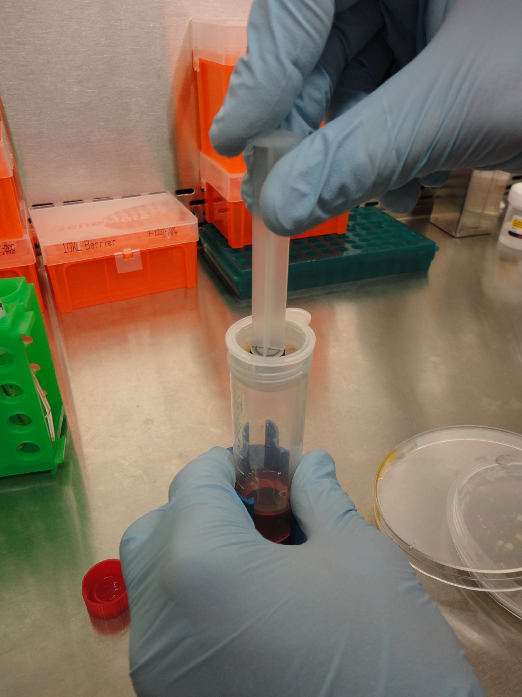 Method for Obtaining Primary Ovarian Cancer Cells From Solid Specimens ...