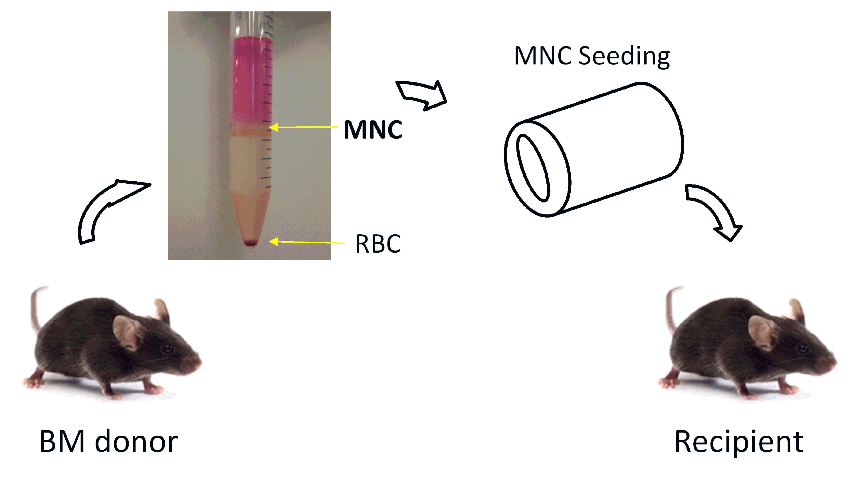 Implantation of Inferior Vena Cava Interposition Graft in Mouse Model ...