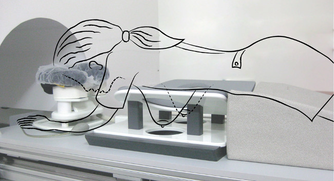 Tracking the Mammary Architectural Features and Detecting Breast Cancer ...