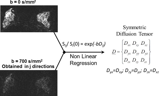 Tracking the Mammary Architectural Features and Detecting Breast Cancer with Magnetic Resonance ...