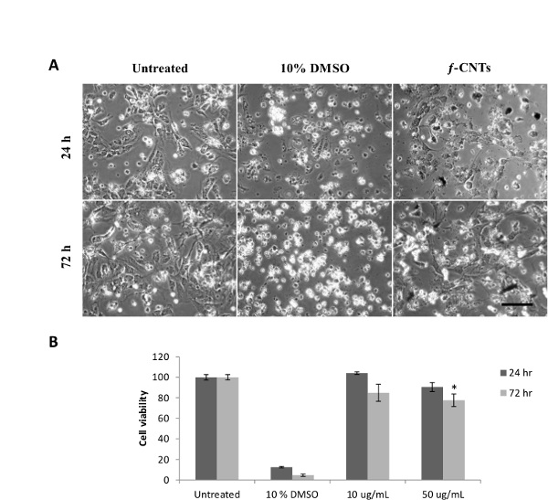 Kupffer Cell Isolation for Nanoparticle Toxicity Testing (Scientific ...