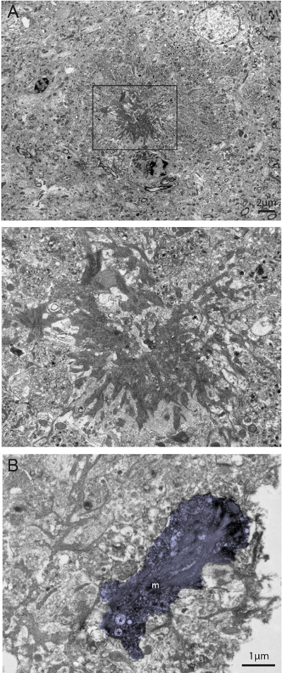Correlative Light and Electron Microscopy to Study Microglial ...