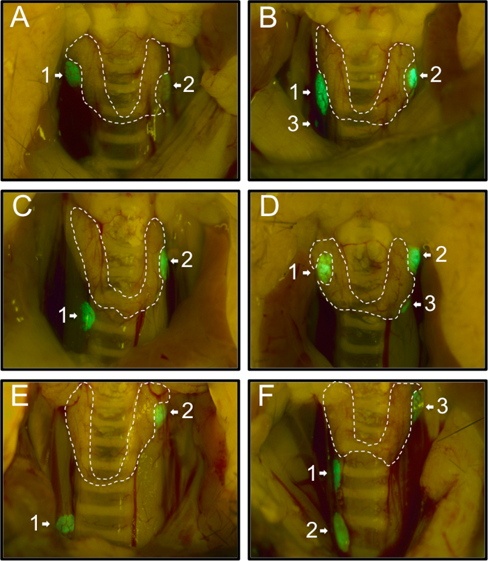 Two Techniques To Create Hypoparathyroid Mice Parathyroidectomy Using 