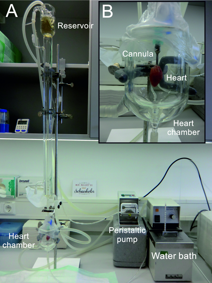 Simultaneous Isolation of High Quality Cardiomyocytes, Endothelial ...