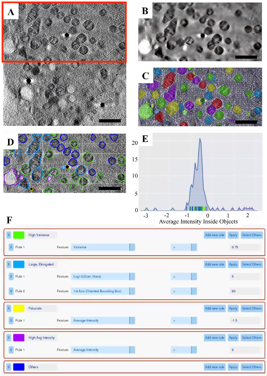 Volume Segmentation And Analysis Of Biological Materials Using Survos