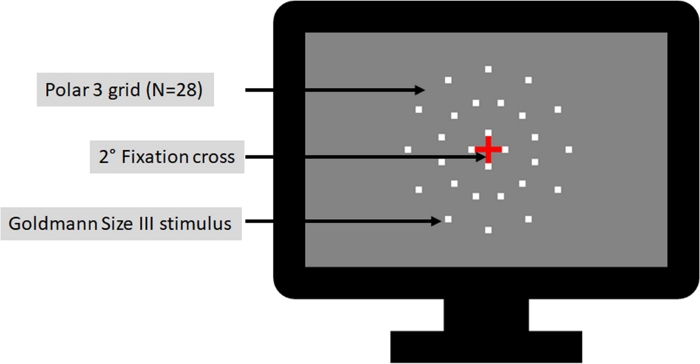 Assessing Binocular Central Visual Field and Binocular Eye Movements in ...
