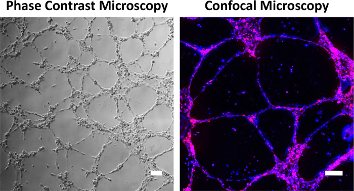 Direct Bioprinting of 3D Multicellular Breast Spheroids onto ...
