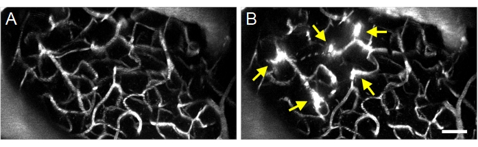 Real-Time Intravital Multiphoton Microscopy to Visualize Focused ...