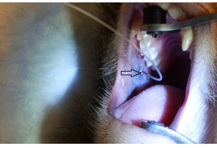 Retrograde Parotid Gland Infusion through Stensen's Duct in a Non-Human ...