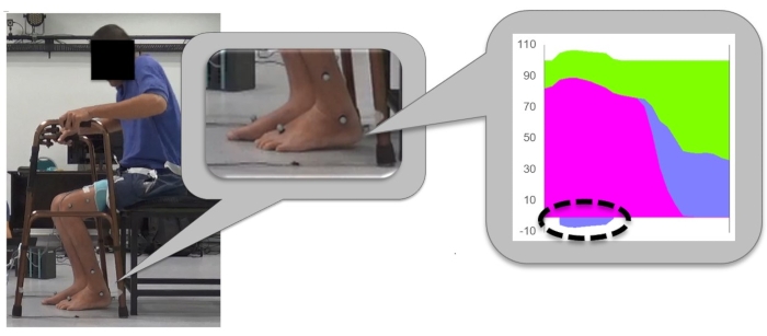 Quantifying Arms and Legs Contributions during Repetitive Electrically ...