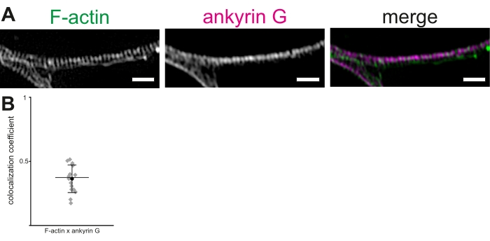 Measuring Properties of the Membrane Periodic Skeleton of the Axon ...