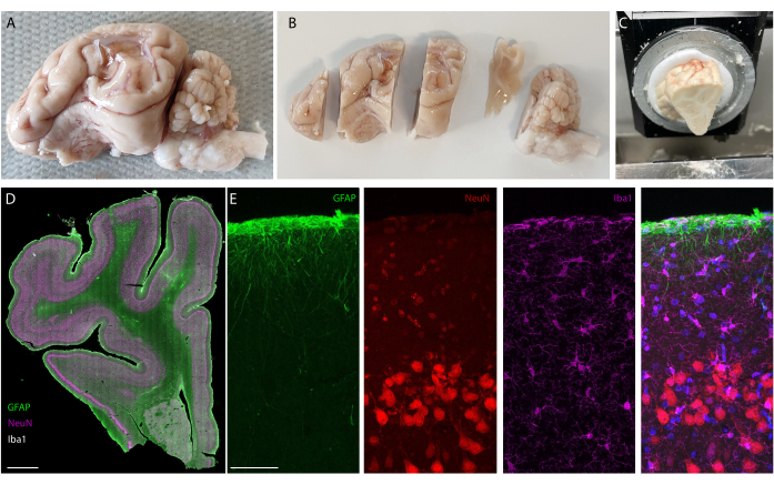 Subdural Soft Electrocorticography ECoG Array Implantation and Long ...