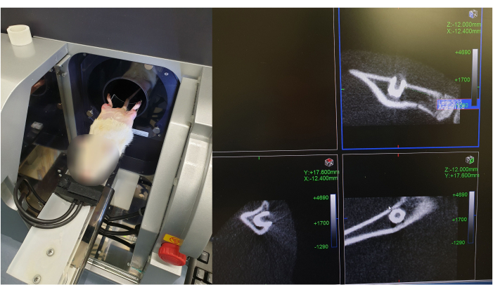 Surgical Bone Implantation Technique for Rat Tibia Models of Diabetes ...