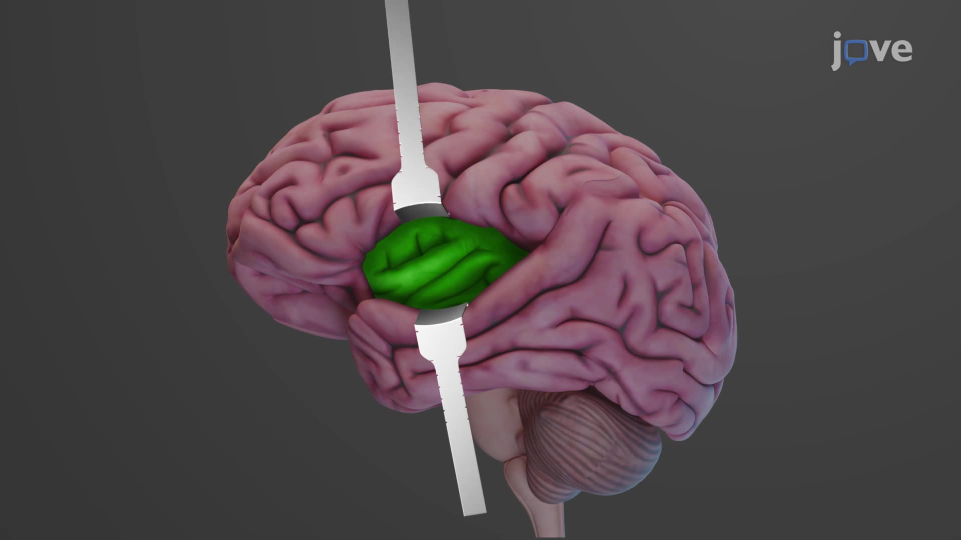 Cerebrum Anatomical Overview I Anatomy And Physiology JoVe